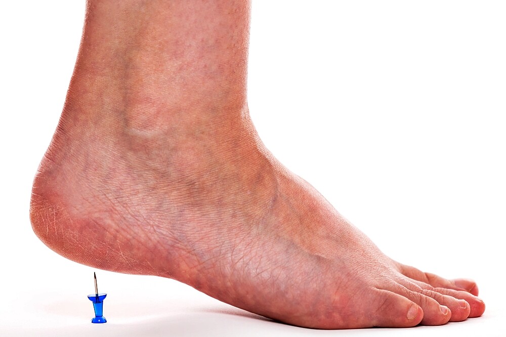 Heel Spur Causes And Treatment
