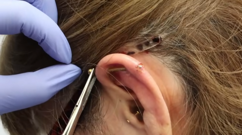 Infected Piercing: That's How You Take Care of It! | Women's Alphabet