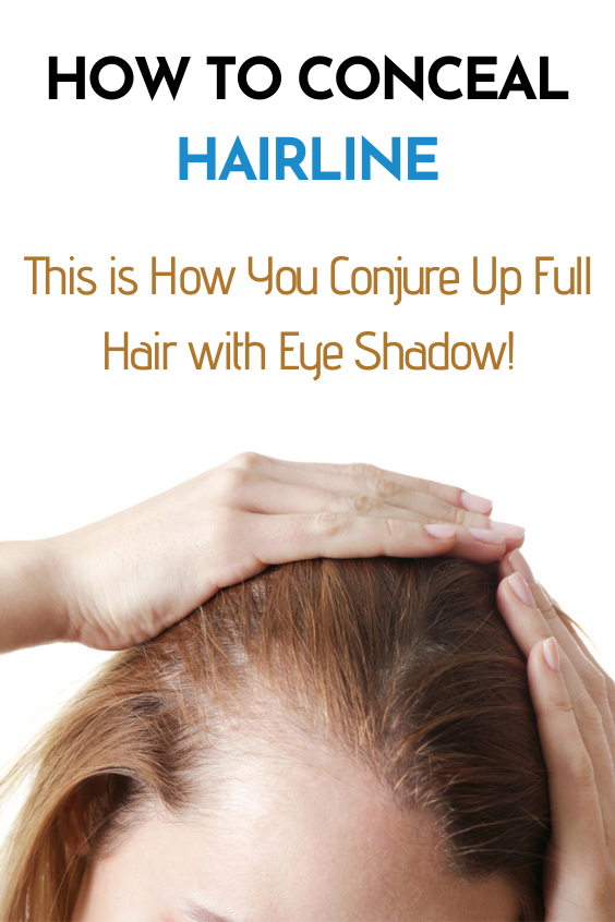 How To Conceal Hairline: This is How You Conjure Up Full Hair with Eye ...