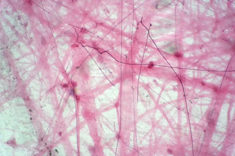 How To Strengthen Connective Tissue: 10 Simple To-Dos | Women's Alphabet