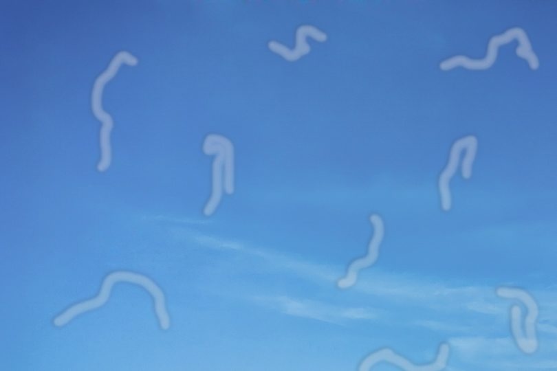 Why Do You Get Eye Floaters? | Women's Alphabet