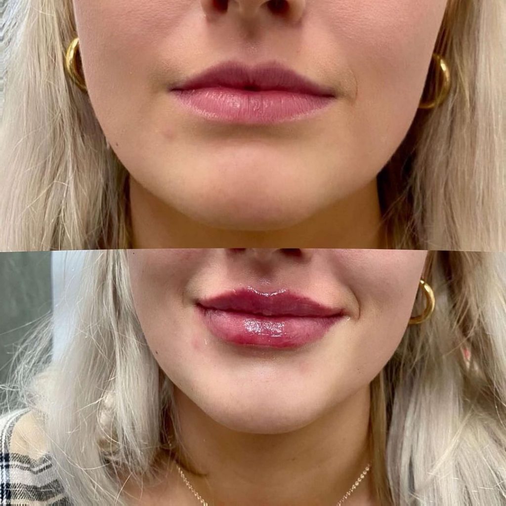 The Perfect Lipstick Ideas for Light Skin | Women's Alphabet